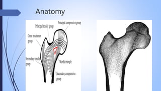 Intra capsular neck of femur fractures | PPTX