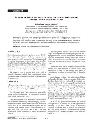 Intra-Fetal Laser Ablation of Umbilical Vessels in Acardiac Twin with ...