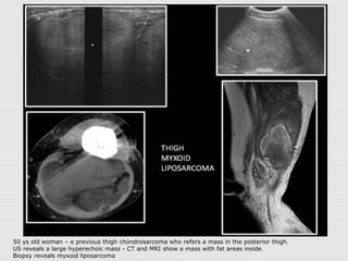 Intra muscular non - traumatic lesions - ultrasonographic evaluation | PPT