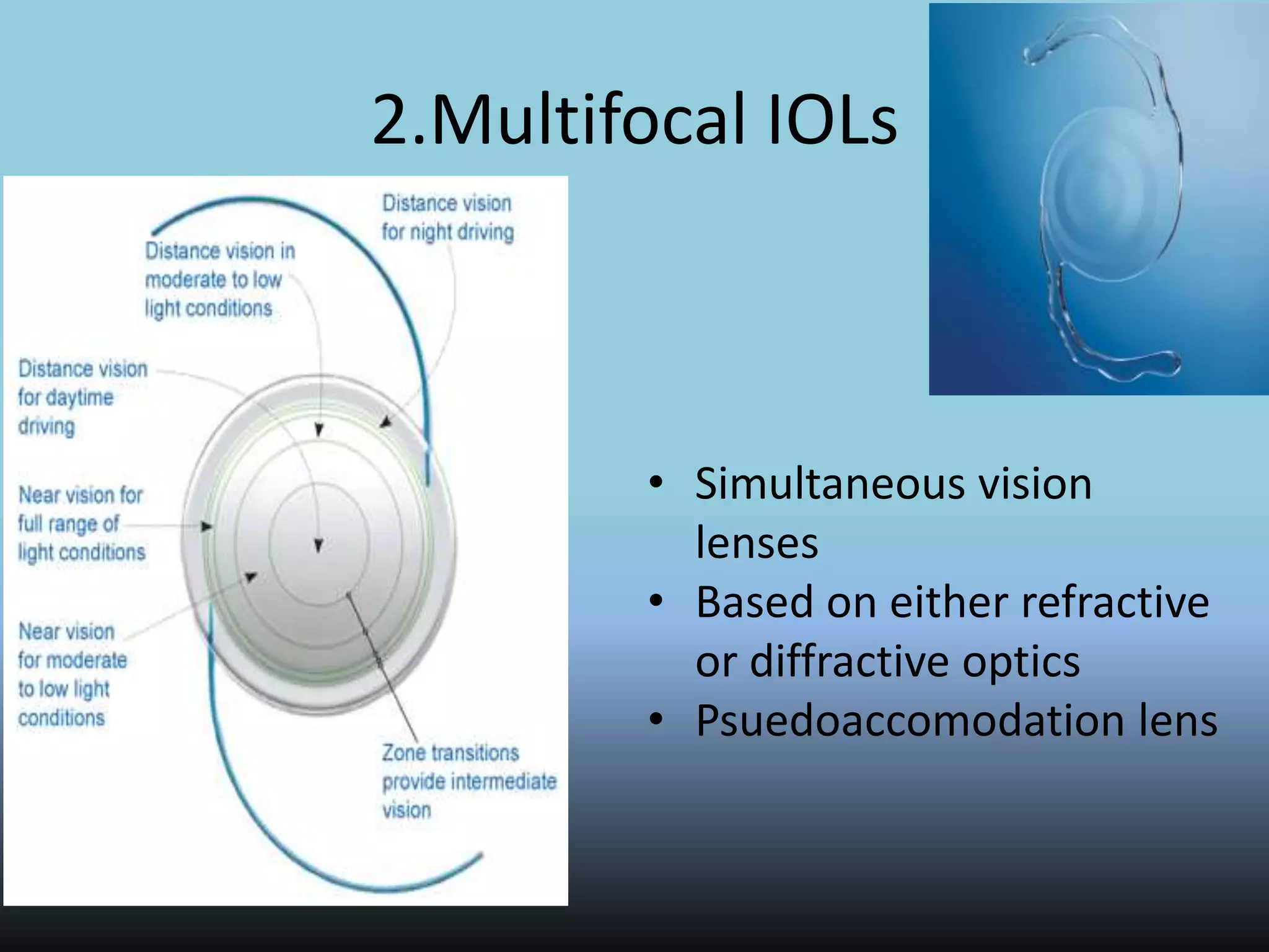 Intra ocular lens | PPTX