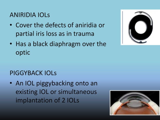 Intra ocular lens | PPTX