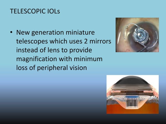 Intra ocular lens | PPTX