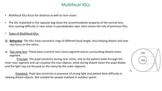 Intra Ocular lens | PPTX