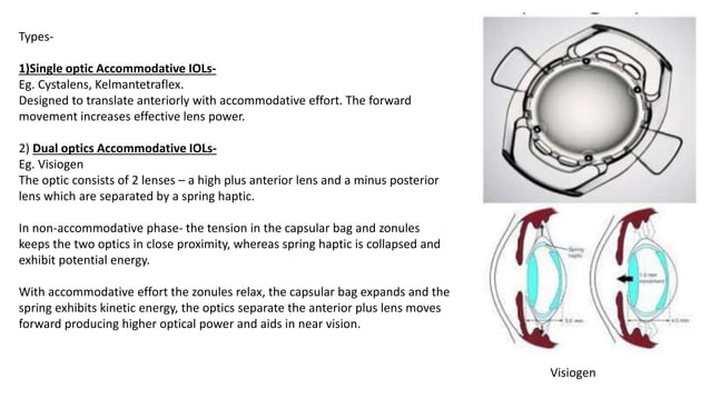 Intra Ocular lens | PPTX | Eye and Vision Conditions | Diseases and ...