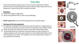 Intra Ocular lens | PPTX