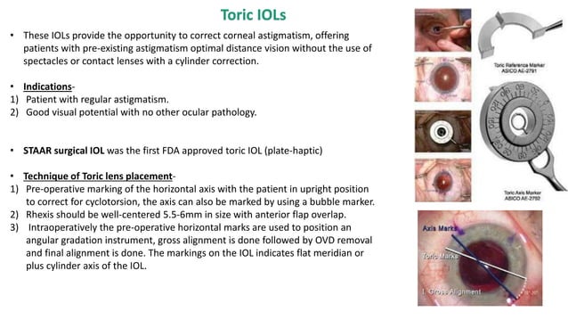 Intra Ocular lens | PPTX | Eye and Vision Conditions | Diseases and Conditions