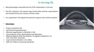 Intra Ocular lens | PPTX