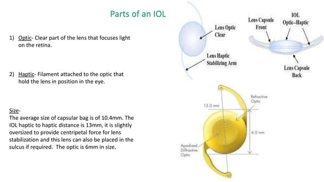 Intra Ocular lens | PPTX | Eye and Vision Conditions | Diseases and ...