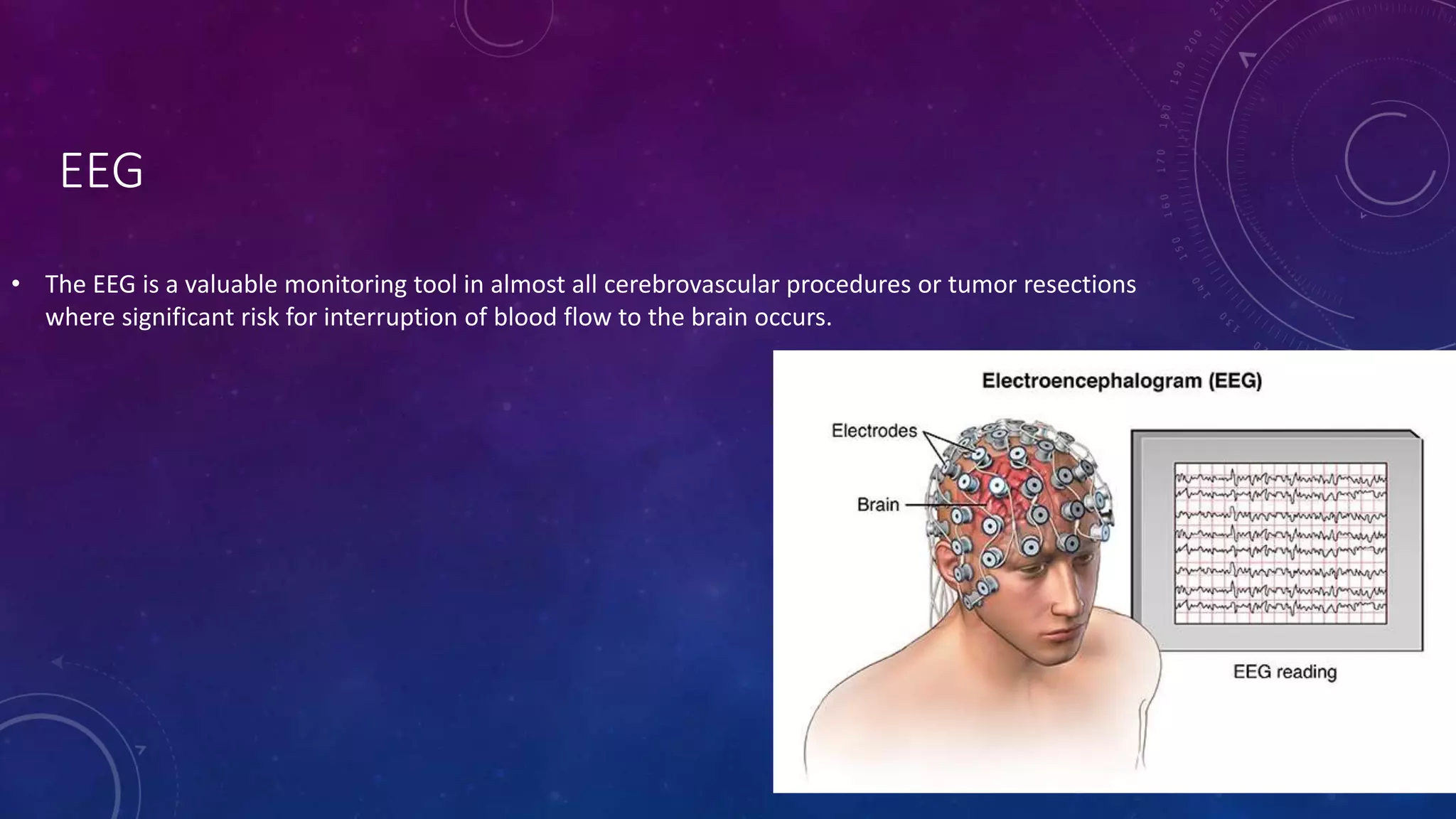 Intra operative neurophysiological monitoring | PPTX