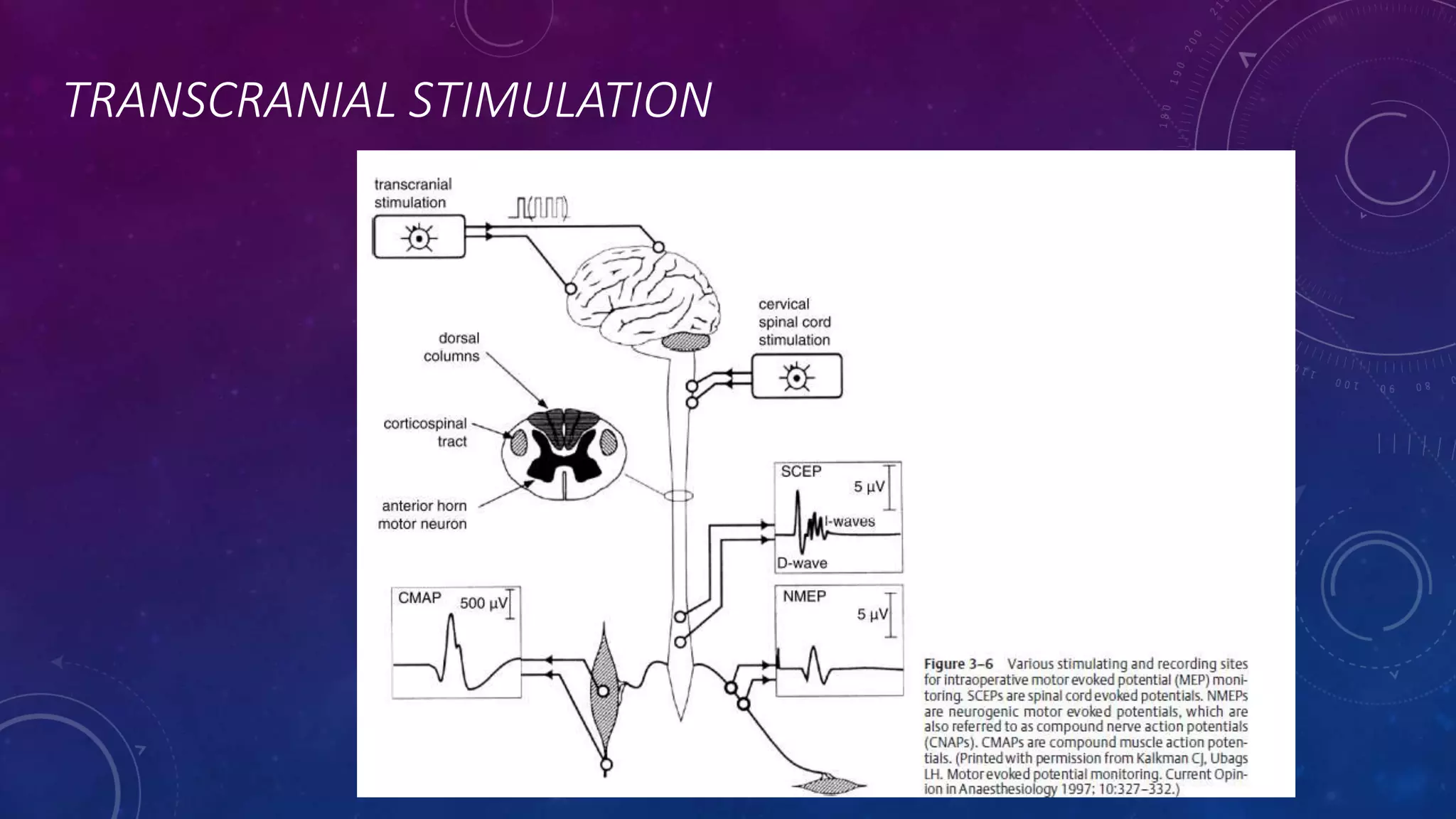 Intra operative neurophysiological monitoring | PPTX