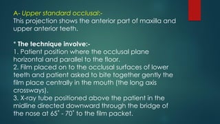 INTRA-ORAL-RADIOGRAPHES-AND-TECHNIQES2020-2.pdf