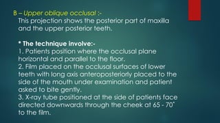 INTRA-ORAL-RADIOGRAPHES-AND-TECHNIQES2020-2.pdf