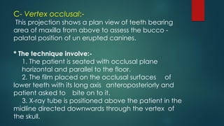 INTRA-ORAL-RADIOGRAPHES-AND-TECHNIQES2020-2.pdf