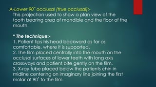 INTRA-ORAL-RADIOGRAPHES-AND-TECHNIQES2020-2.pdf