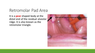 Intra-oral Anatomical Landmarks Related to Removable Prostheses.pdf