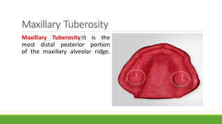 Intra-oral Anatomical Landmarks Related to Removable Prostheses.pdf