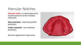 Intra-oral Anatomical Landmarks Related to Removable Prostheses.pdf