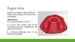 Intra-oral Anatomical Landmarks Related to Removable Prostheses.pdf