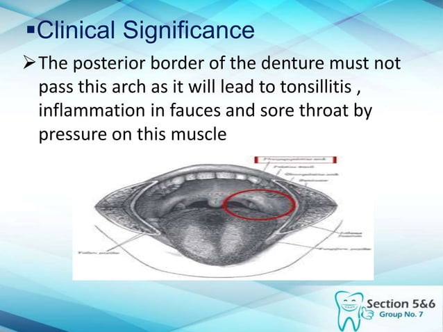 Intra oral mandibular landmarks | PPTX
