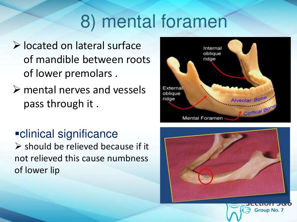 Intra oral mandibular landmarks