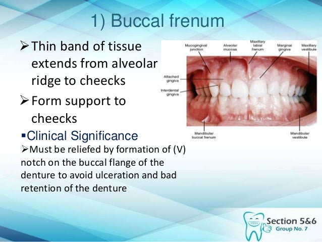 Intra oral mandibular landmarks