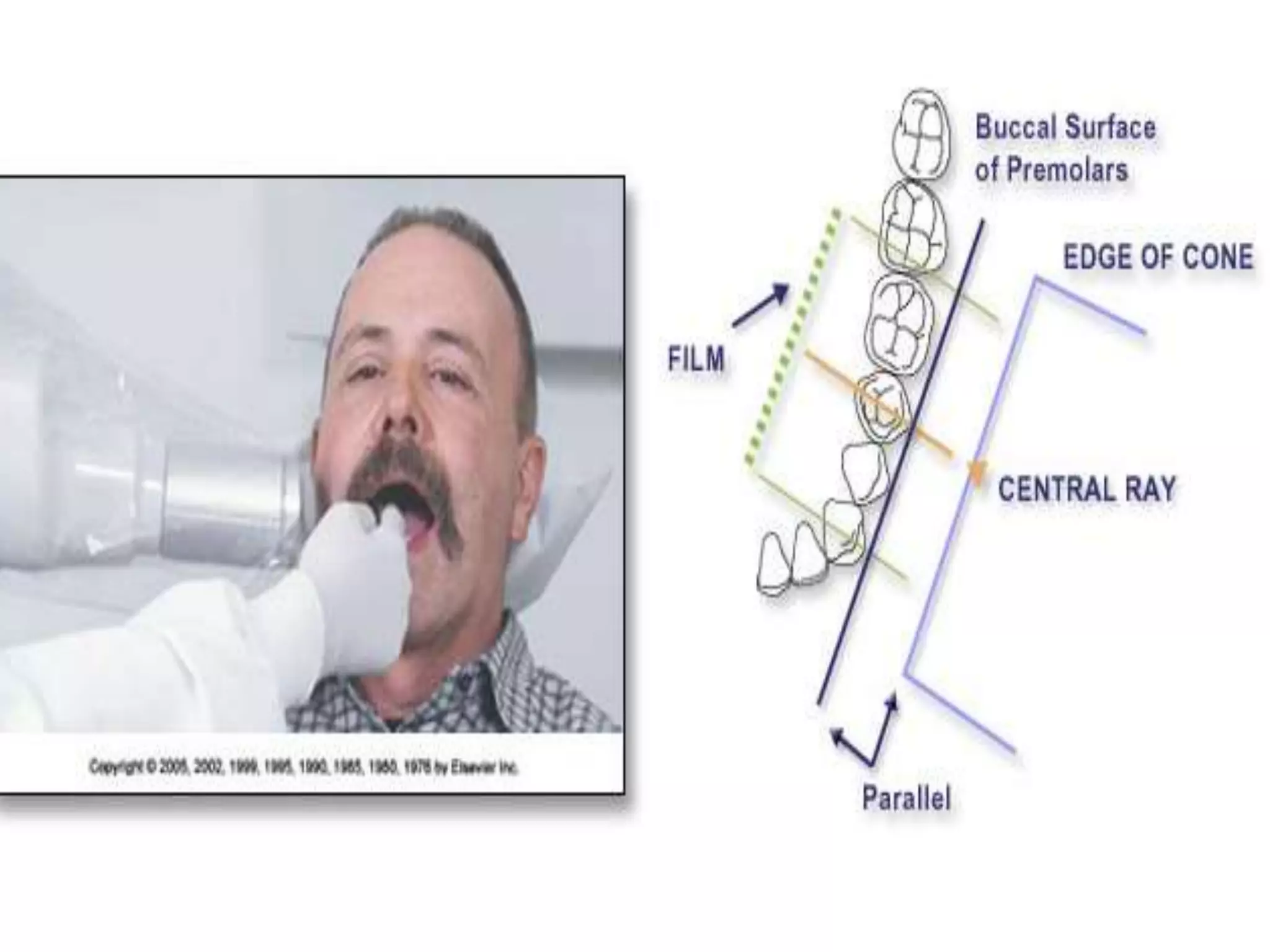 Intra oral radiograph techniques | PPTX