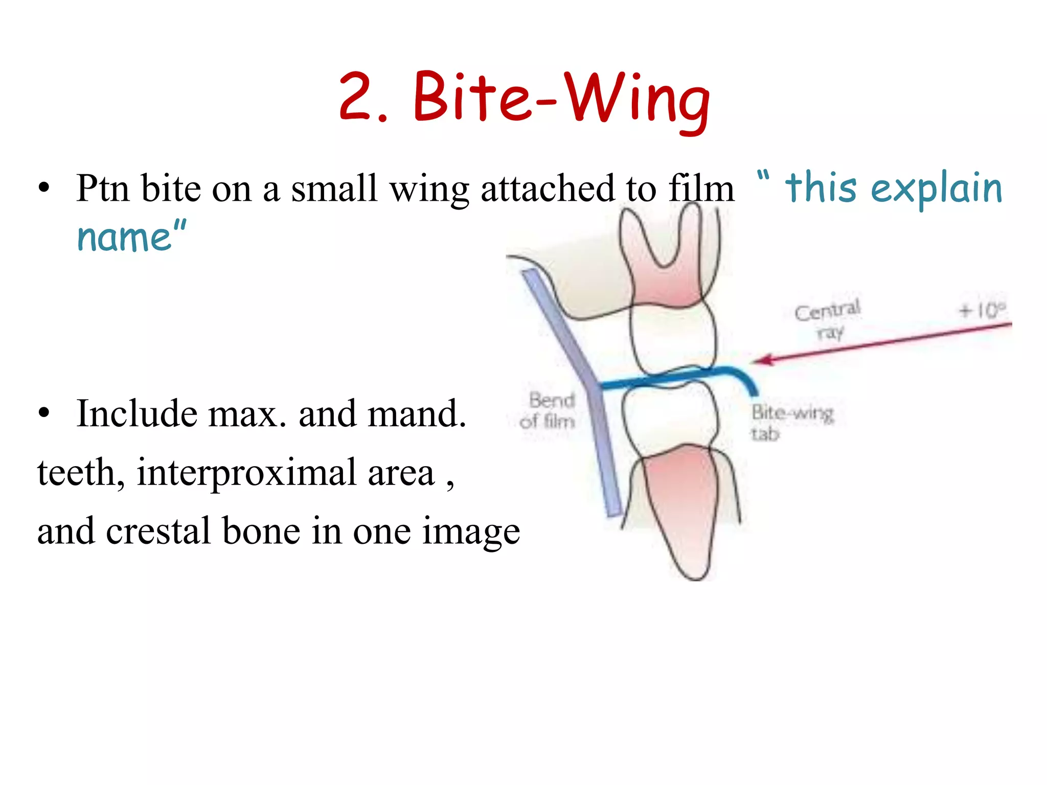 Intra oral radiograph techniques | PPTX