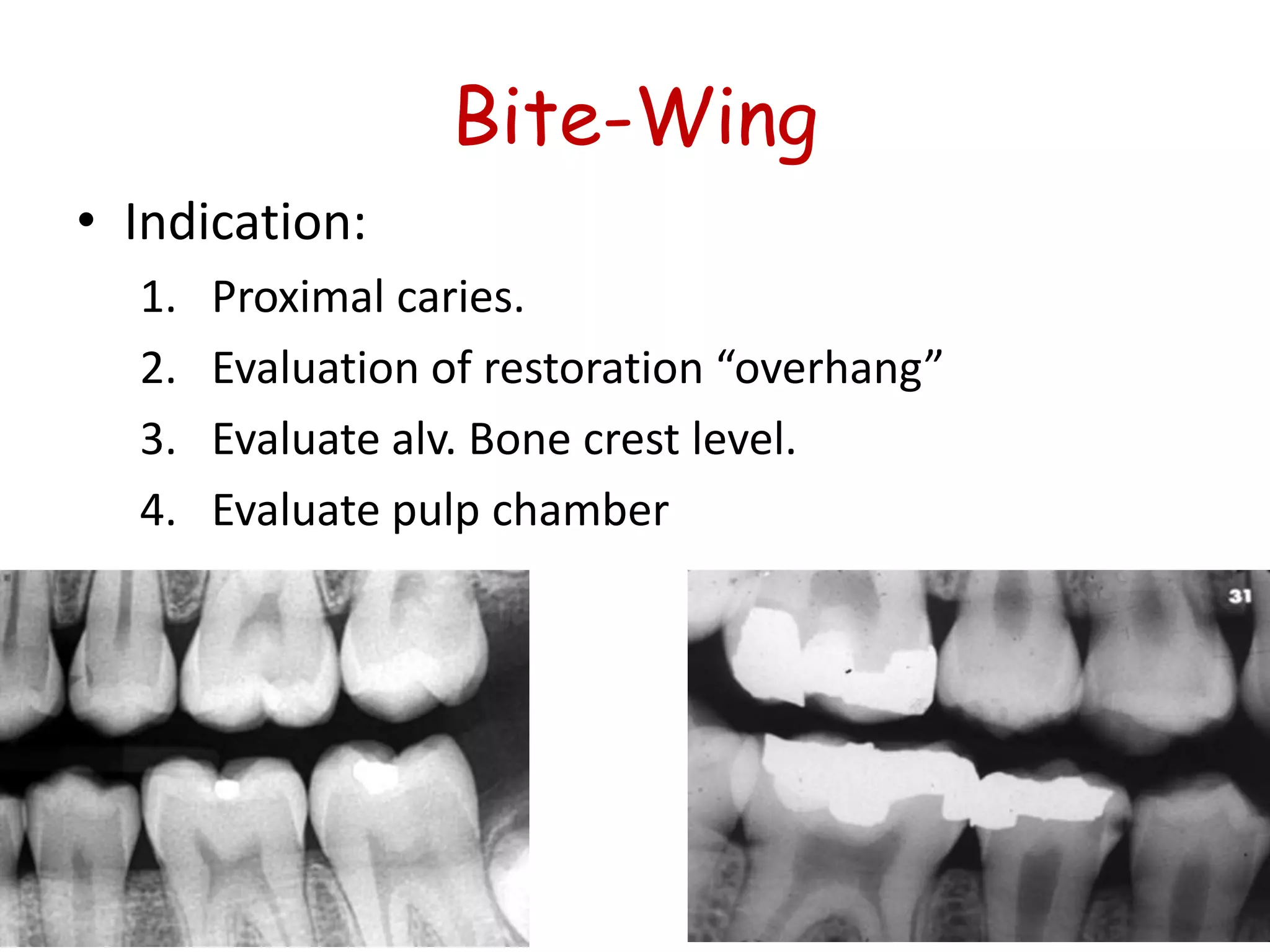 Intra oral radiograph techniques | PPTX