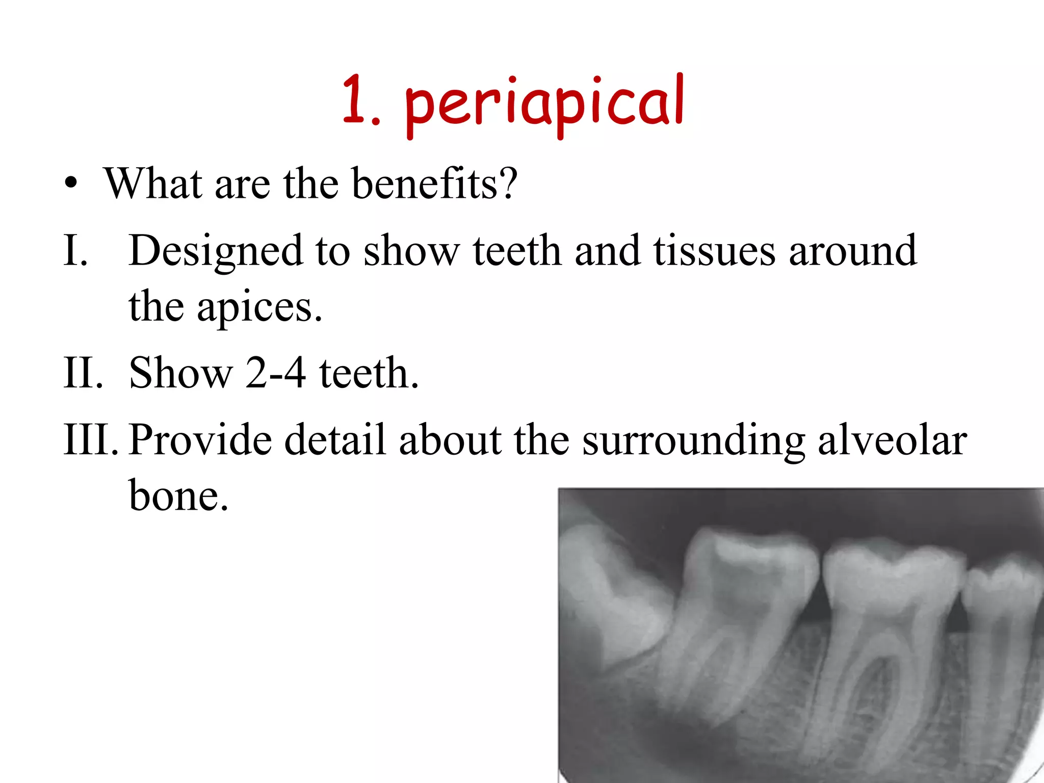 Intra oral radiograph techniques | PPTX