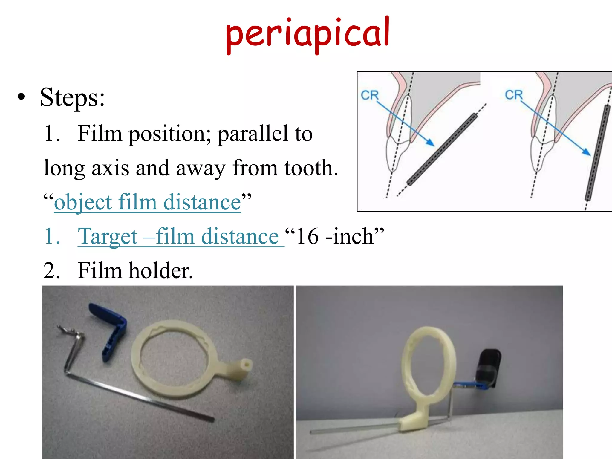 Intra oral radiograph techniques | PPTX
