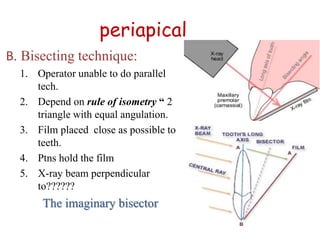 Intra oral radiograph techniques | PPTX