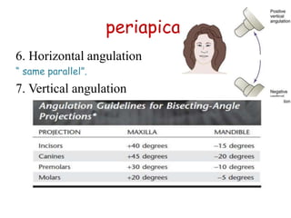 Intra oral radiograph techniques | PPTX