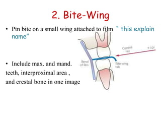 Intra oral radiograph techniques | PPTX