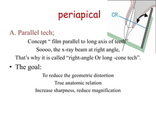 Intra oral radiograph techniques | PPTX