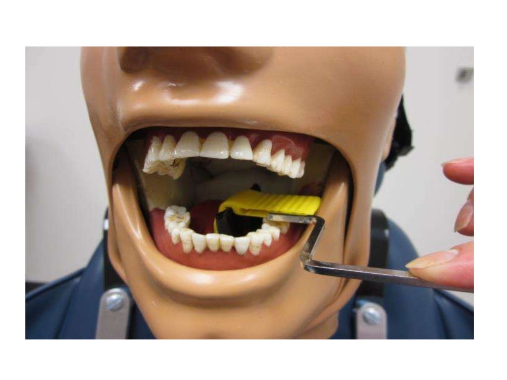 Intra oral radiograph techniques