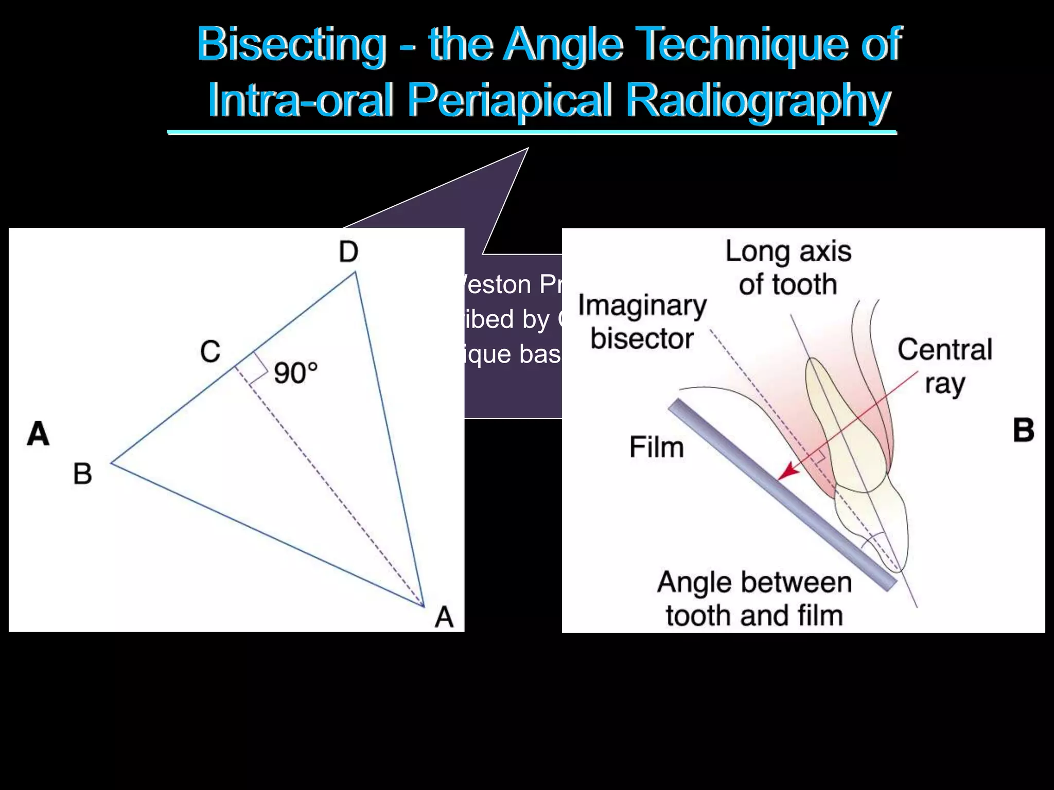 Intra-Oral Radiography.pptx | Dental Health | Diseases and Conditions