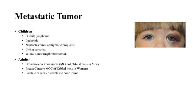 Intra-orbital tumors - Diagnosis & Management Part 1 | PPT