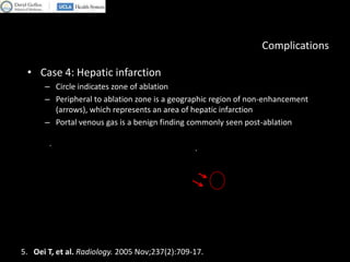Intra procedural ct during rfa final | PPT