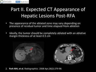 Intra procedural ct during rfa final | PPT