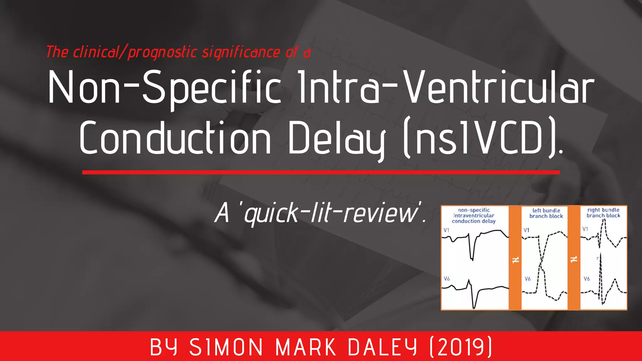 Non-Specific Intra-Ventricular Conduction Delay - A quick-lit-review | PDF