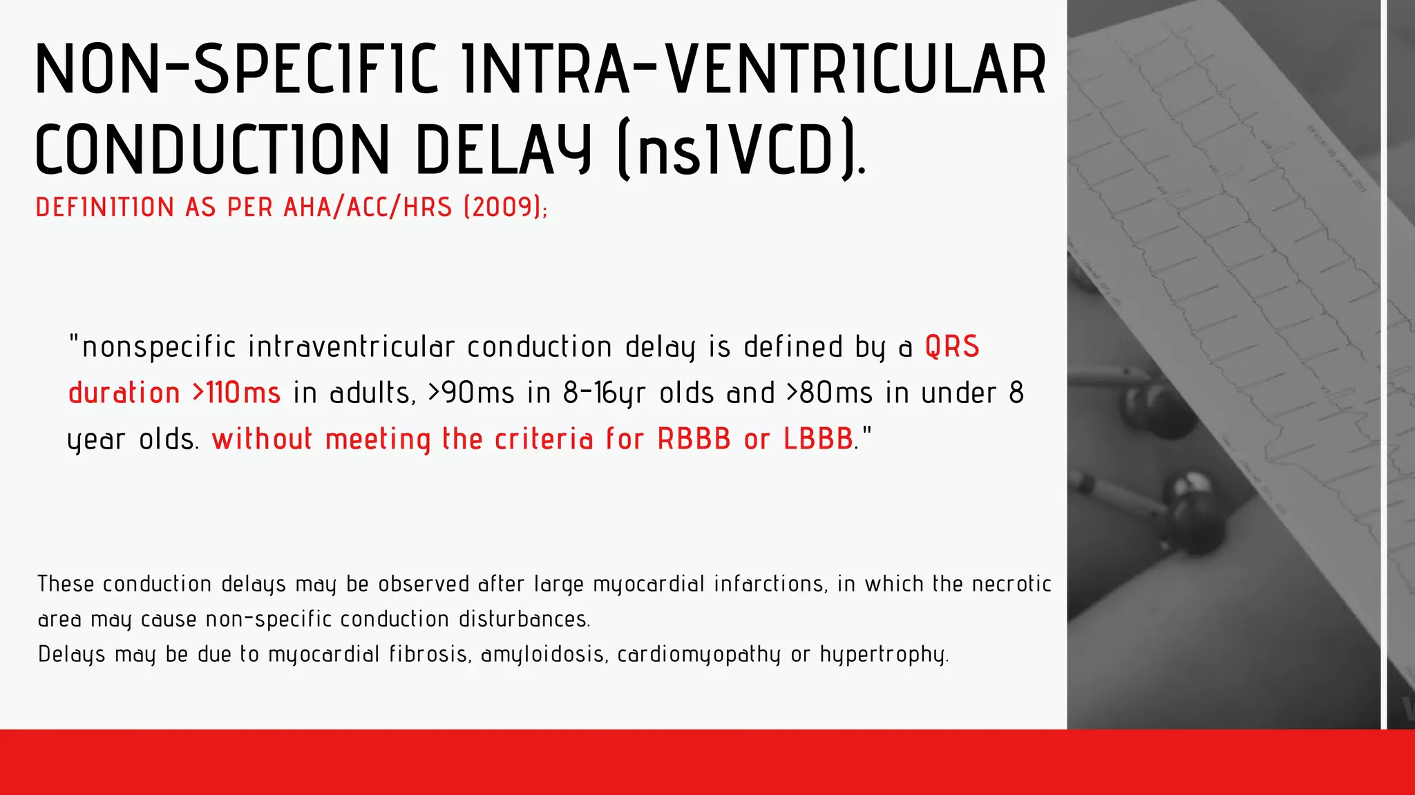 Non-Specific Intra-Ventricular Conduction Delay - A quick-lit-review | PDF