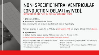 Non-Specific Intra-Ventricular Conduction Delay - A quick-lit-review | PDF