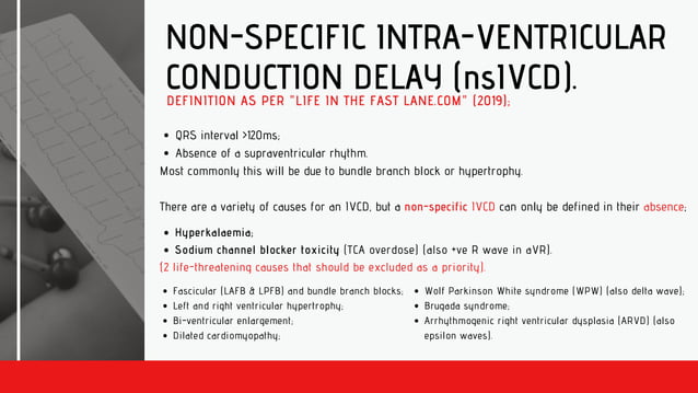 Non-Specific Intra-Ventricular Conduction Delay - A quick-lit-review
