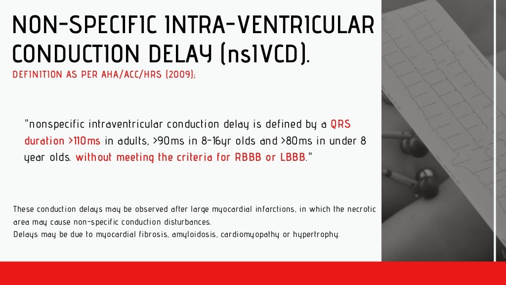 Non-Specific Intra-Ventricular Conduction Delay - A quick-lit-review