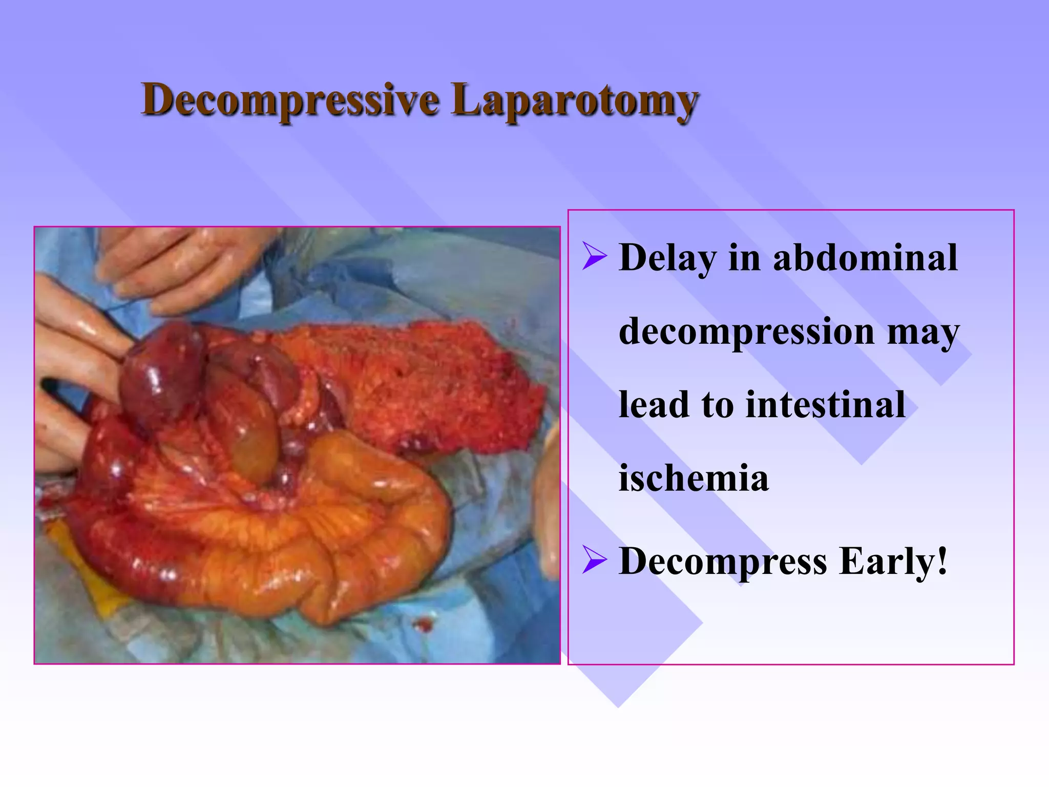 Intra Abdominal hypertension&Abdominal Compartment Syndrome | PPTX