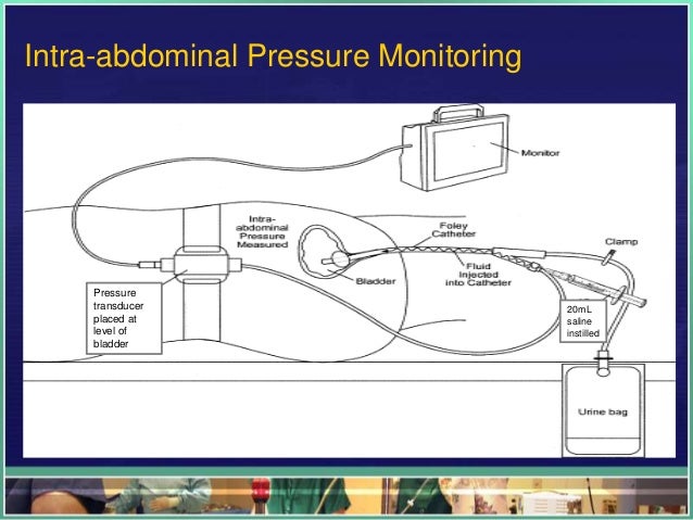 Intra-abdominal hypertension and abdominal compartment syndrome