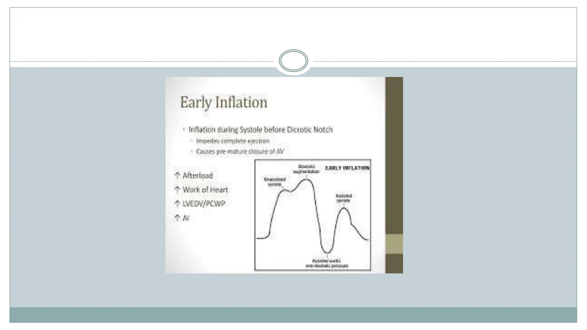 INTRA AORTIC BALLON PUMP [IABP].ppt news | PPT