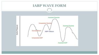 INTRA AORTIC BALLON PUMP [IABP].ppt news | PPT