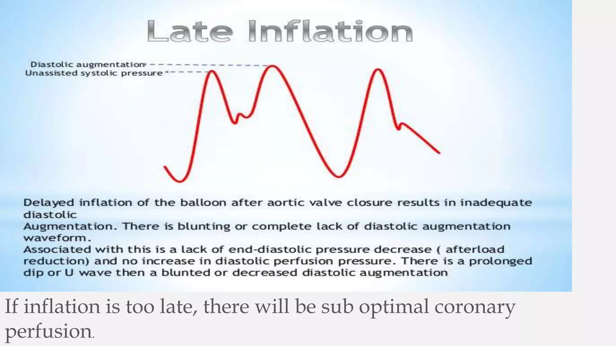 Intra aortic balloon pump and ECMO | PPTX