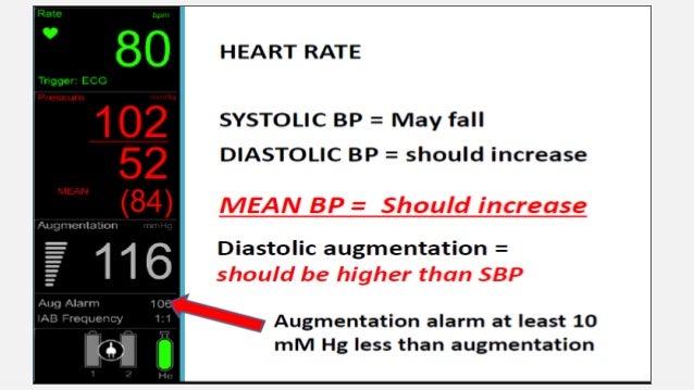 Intra aortic balloon pump and ECMO